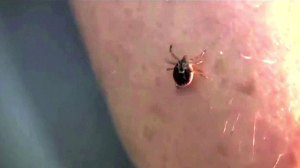 Tick season has arrived in Massachusetts | WRGB